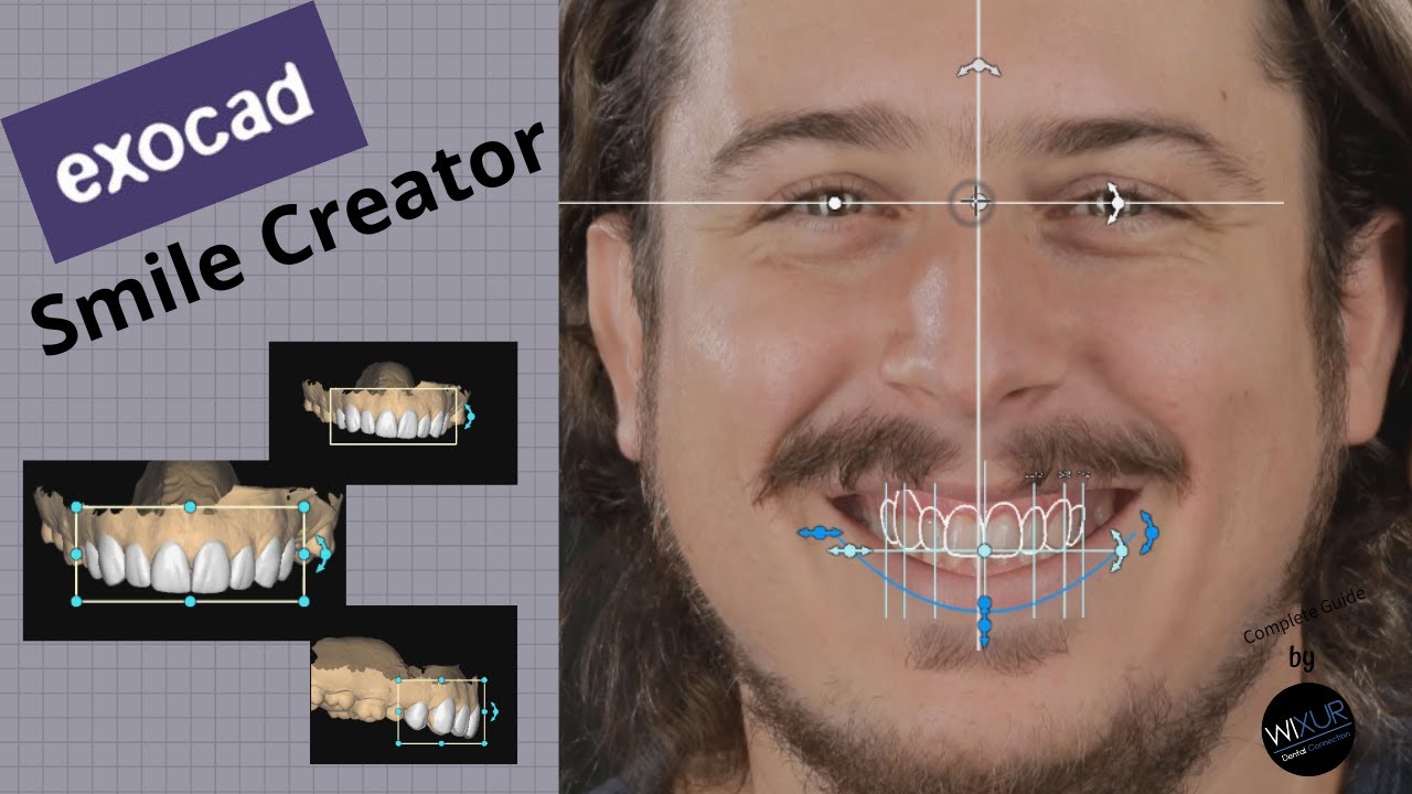 Transform Your Smile with Digital Smile Design - Autumn Lake Dental Blog